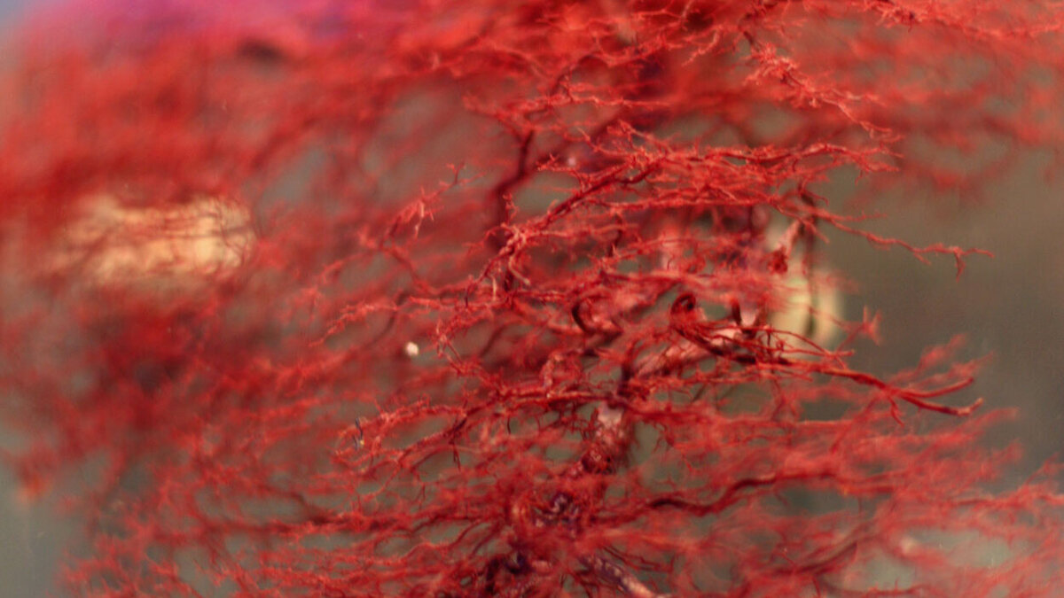 Blood flows are more turbulent than previously suspected - scilog